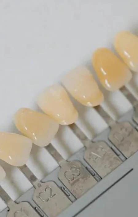Yellow Teeth | Common Problems | Cranbourne North Dental